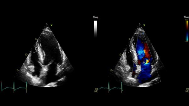 Τρίπλεξ Καρδιάς - Καρδιολόγος Σακαδάκης Ελευθέριος